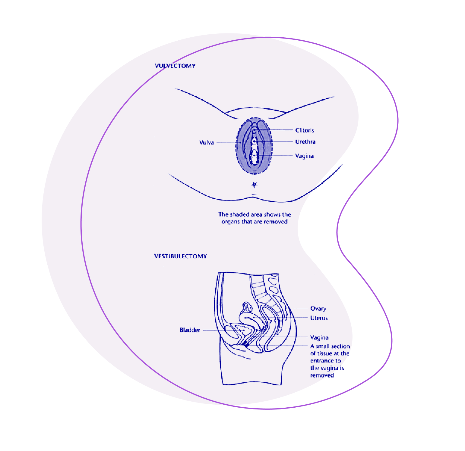 Cancer | Gynaecologist Consultant | London